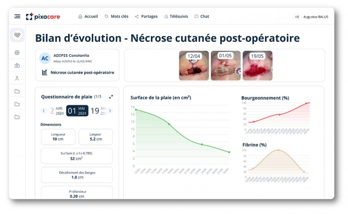 Pixacare soigne un nouveau tour | CFNEWS